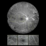 ZEISS Clarus 700 | Fundus Imaging | shapeophthalmics.com