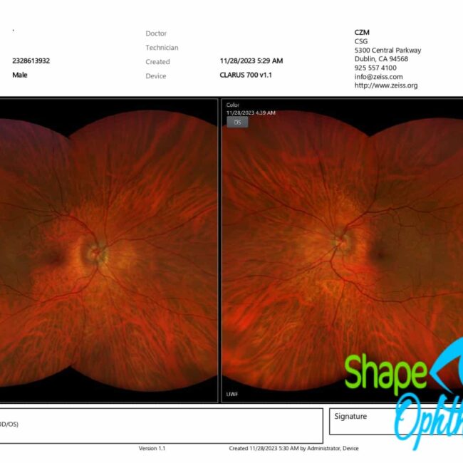 ZEISS Clarus 700 | Fundus Imaging | shapeophthalmics.com