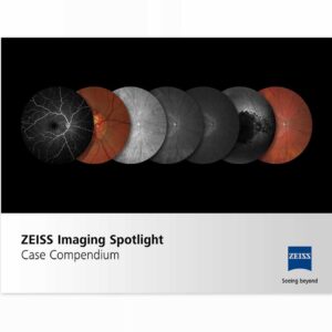 ZEISS Clarus 700 | Fundus Imaging | shapeophthalmics.com
